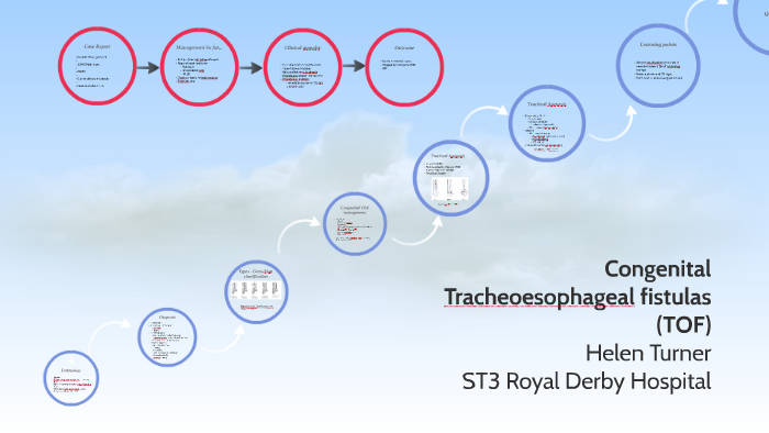 Tracheoesophageal Fistula (TOF) by Helen Turner on Prezi
