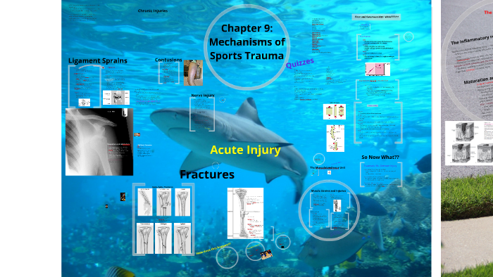SM II Sports Trauma by Kembra Mathis on Prezi