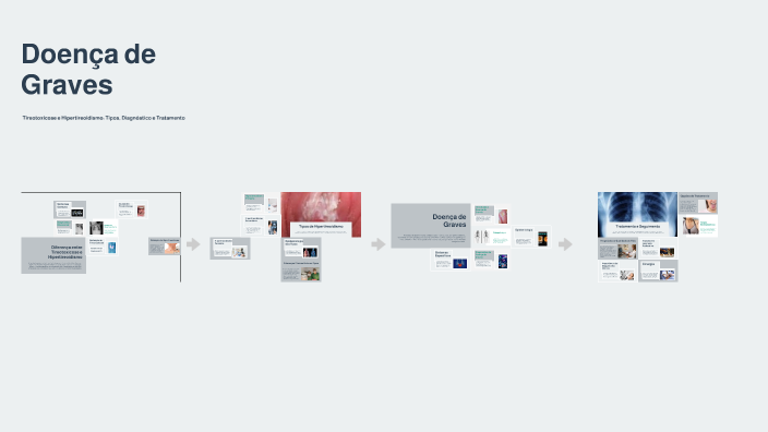 Doença de Graves by Luiza Azevedo Gross on Prezi