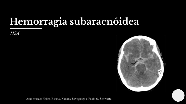 Hemorragia subaracnóidea by Kauany Savegnago on Prezi