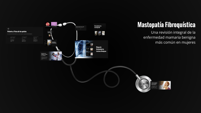 Mastopatía Fibroquística by Jonathan Montesinos on Prezi