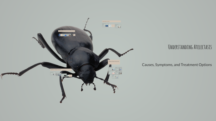 Understanding Atelectasis by zeus shmoose on Prezi