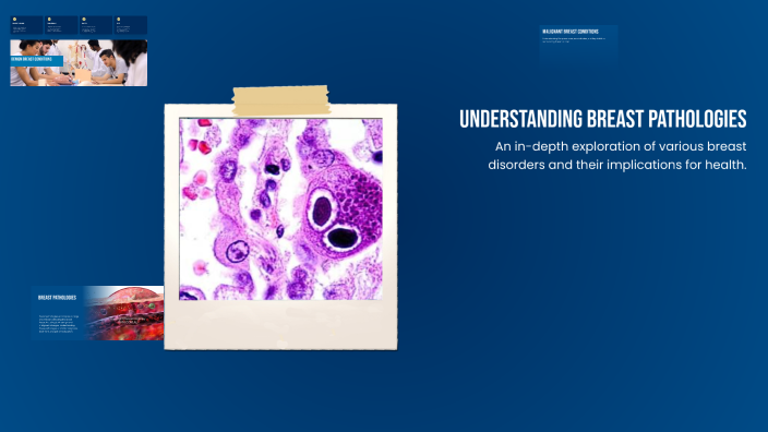 Understanding Breast Pathologies by Chris Lovick on Prezi