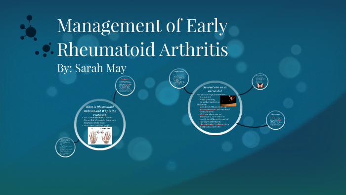 Management of Early Rheumatoid Arthritis by Sarah May