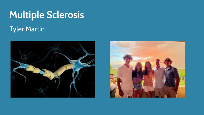 Multiple Sclerosis real by Tyler Martin on Prezi