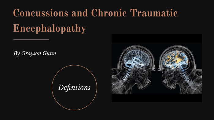 CTE and Concussions by Grayson G on Prezi