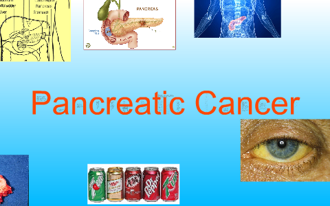 pancreatic cancer research project castle science by max rakutt on Prezi