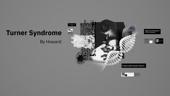 Turner Syndrome by howard wang on Prezi