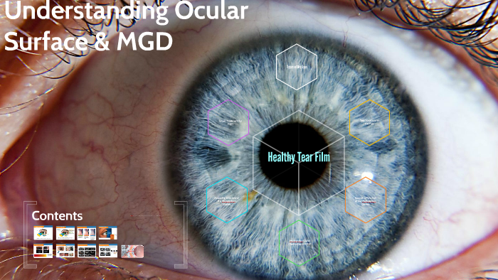 Understanding Ocular Surface & MGD by Sean Teo on Prezi
