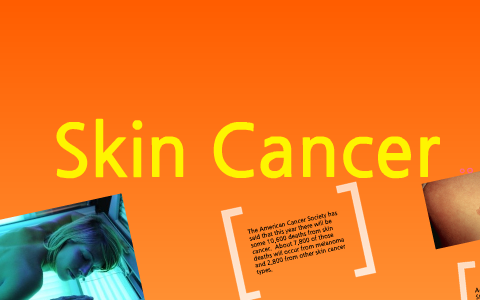 Skin Cancer Project by Alexis King on Prezi