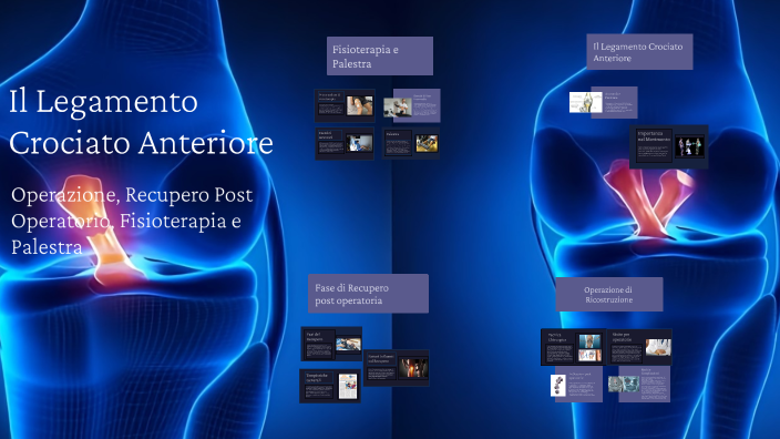 Legamento Crociato Anteriore by Luca Mocanu on Prezi