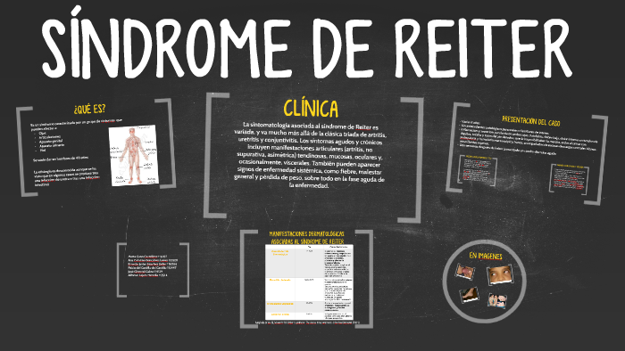 SÍNDROME DE REITER by Fonsy Lahe on Prezi