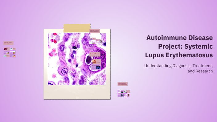 Autoimmune Disease Project: Systemic Lupus Erythematosus by rebecca ...