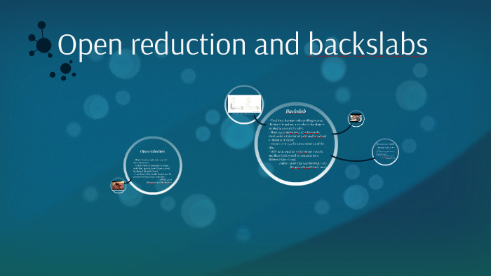 Open reduction and backslabs by Emma Gott on Prezi