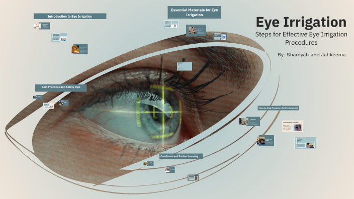 Eye Irrigation Techniques by Shamyah Joseph on Prezi