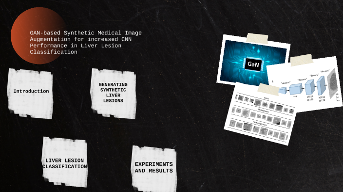 Gan Based Synthetic Medical Image Augmentation For Increased Cnn Performance In Liver Lesion
