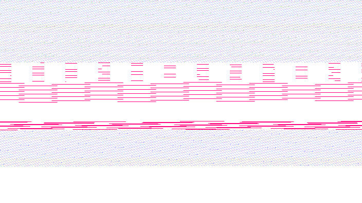 Hipertensión Arterial Relacionada con el Embarazo by Meribeth Sánchez ...