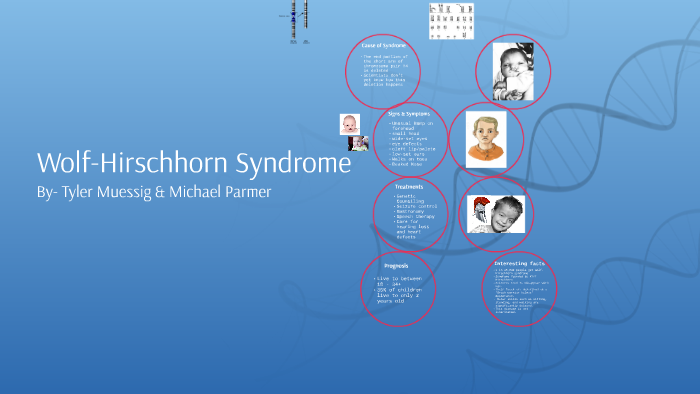 Wolf-Hirschhorn Syndrome by Ty Muessig on Prezi