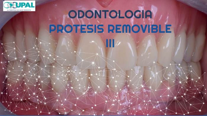 CASO CLINICO PROTESIS REMO by Ramiro Olivera Carrillo on Prezi
