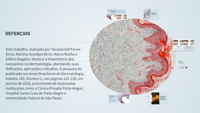 Explorando a Realidade dos Exossomos na Dermatologia by Amanda Muhl on ...