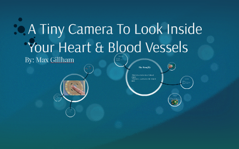 A Tiny Camera To Look Inside Your Heart & Blood Vessels by Max Gillham ...