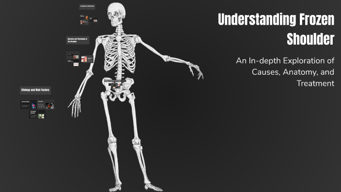 Understanding Frozen Shoulder by Amit Bhanot on Prezi