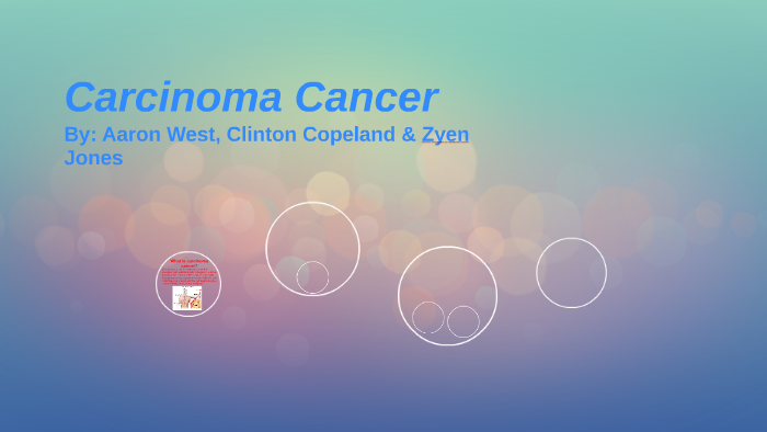 Carcinoma Cancer by Clinton Copeland on Prezi