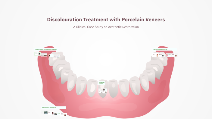 Discolouration Treatment with Porcelain Veneers by Elham Bagheri on Prezi