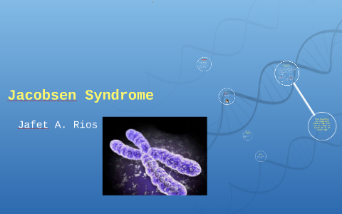 Jacobson's Syndrome by Jafet Arredondo Rios