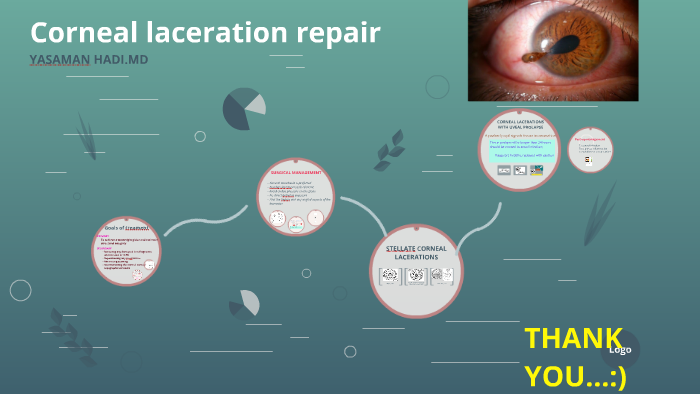 Corneal laceration repair by yas hadi on Prezi