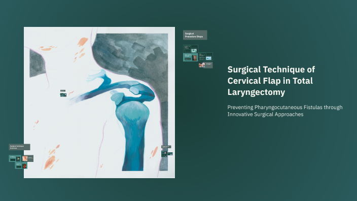Surgical Technique of Cervical Flap in Total Laryngectomy by Labdhy ...