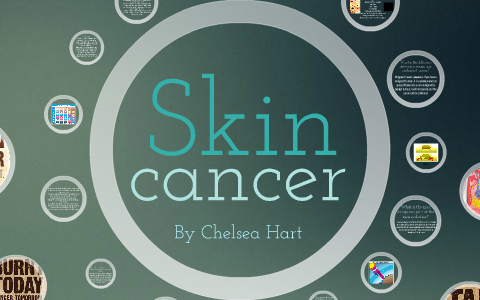 Skin Cancer-Science Project by Chelsea Hart