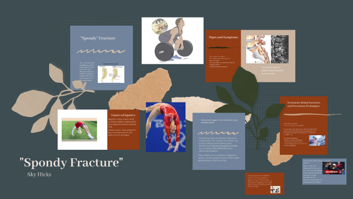 "Spondy" Fracture by Sky Hicks on Prezi