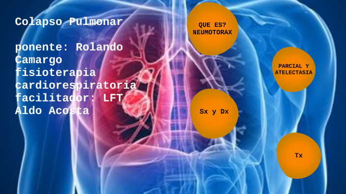 COLAPSO PULMONAR by Rolando Camargo Gastélum on Prezi