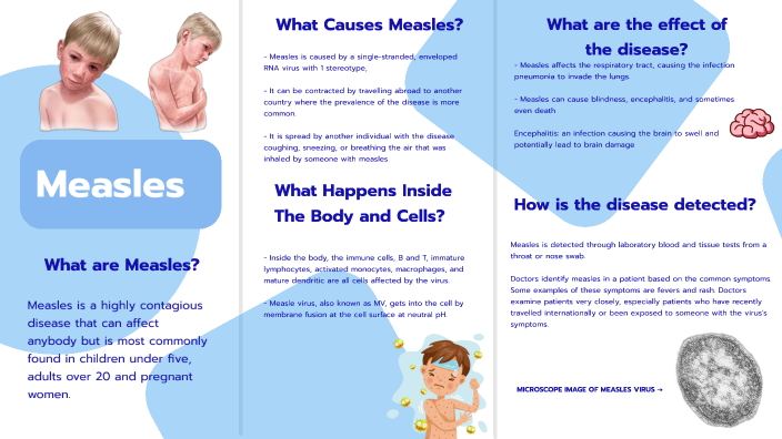 Science pamphlet - Measles - Marley Spinks, Natalie Ma by Natalie Ma on ...