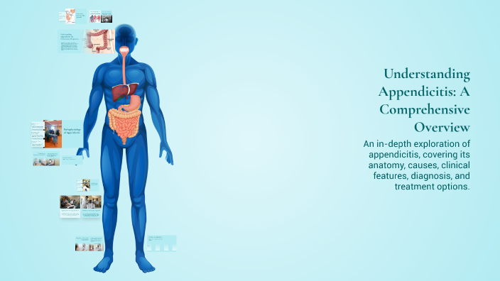 Understanding Appendicitis: A Comprehensive Overview by Ezz Kitt on Prezi
