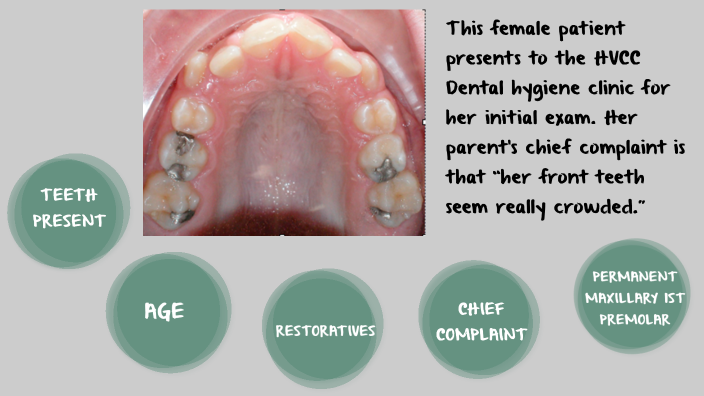 Tooth Morphology Project by Maria Albery on Prezi