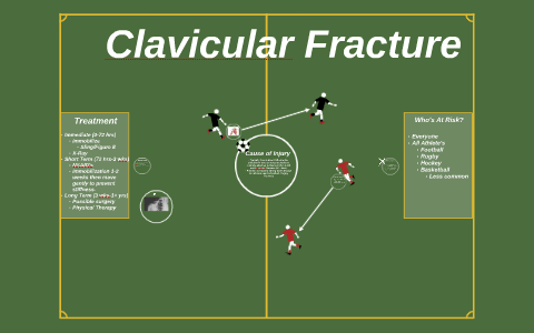 Clavicular Fracture by Braydon Shields on Prezi