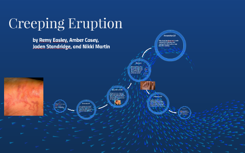 Creeping Eruption by Remy Easley on Prezi