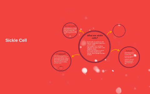 Sickle Cell by Luke Modzelewski on Prezi