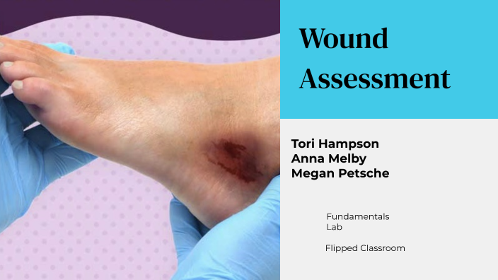 Wound Group 1- Tori, Anna, and Megan by Victoria Hampson on Prezi