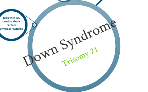 Anatomy : Down Syndrome by Lasha Wilson on Prezi