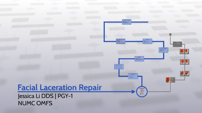 Facial Laceration Repair by Jessica Li on Prezi