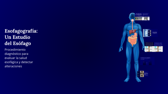 Esofagografía: Un Estudio del Esófago by JASMIN YANDIRA CORO GUTIERREZ ...