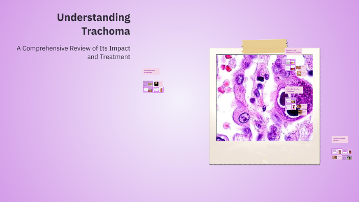 Understanding Trachoma by Ashley Lazo on Prezi