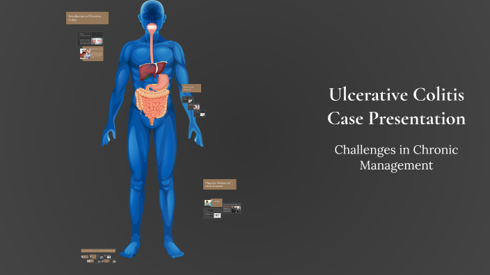 Ulcerative Colitis Case Presentation by ahmed mostafa on Prezi