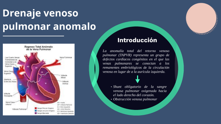 Drenaje venoso pulmonar anomalo by Elisa Alexandra on Prezi
