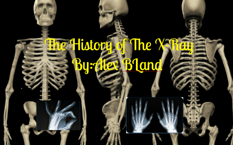 x-ray history by Alexander Bland on Prezi