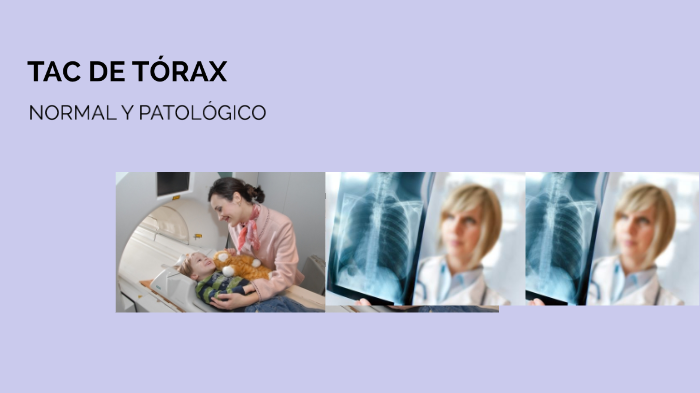 TAC DE TORAX NORMAL Y PATOLOGICO by JENNIFER RIOFRIO on Prezi