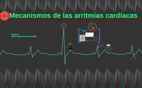 Mecanismos de las arritmias cardíacas by Flores Maria Alejandra on Prezi